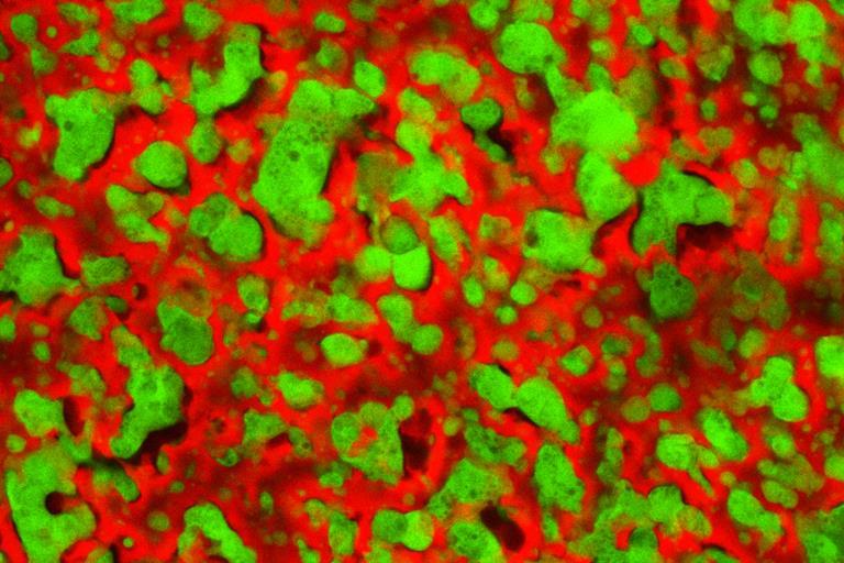 Plant-based food revolution | Article | Chemistry World